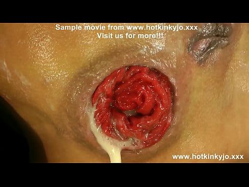 Hot pornstar Hotkinkyjo auto fisting anal en sexy vestido negro y prolapso anal - XVIDEOS.COM